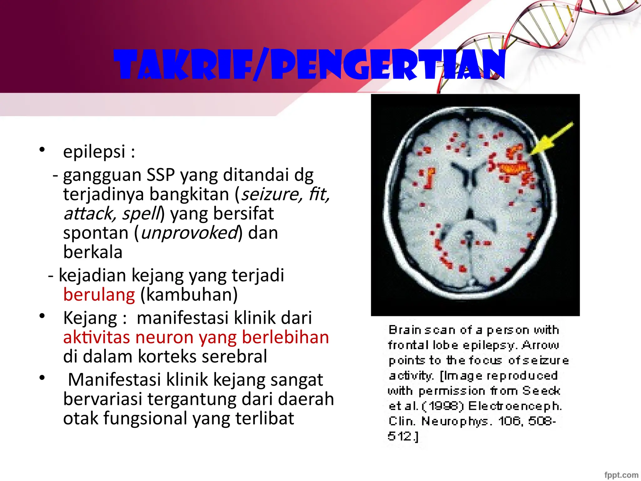 Mengenal Epilepsi secara garis besar.pptx