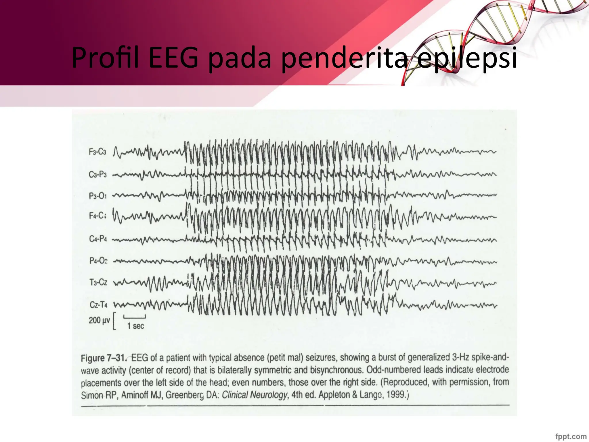 Mengenal Epilepsi secara garis besar.pptx
