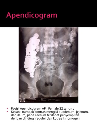 230877747-Kumpulan-Foto-Case-Radiologi.ppt