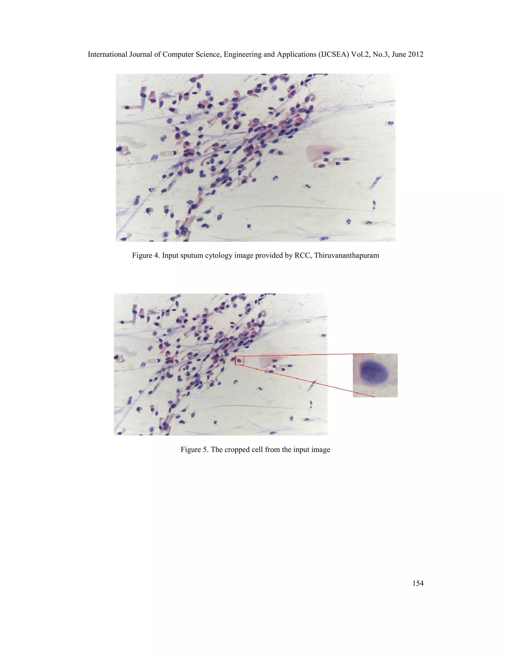 SEGMENTATION OF LUNG GLANDULAR CELLS USING MULTIPLE COLOR SPACES | PDF SEGMENTATION OF LUNG GLANDULAR CELLS USING MULTIPLE COLOR SPACES | PDF