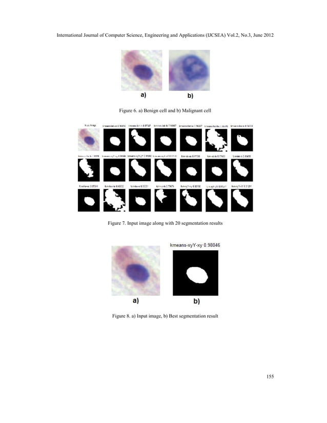 SEGMENTATION OF LUNG GLANDULAR CELLS USING MULTIPLE COLOR SPACES | PDF SEGMENTATION OF LUNG GLANDULAR CELLS USING MULTIPLE COLOR SPACES | PDF