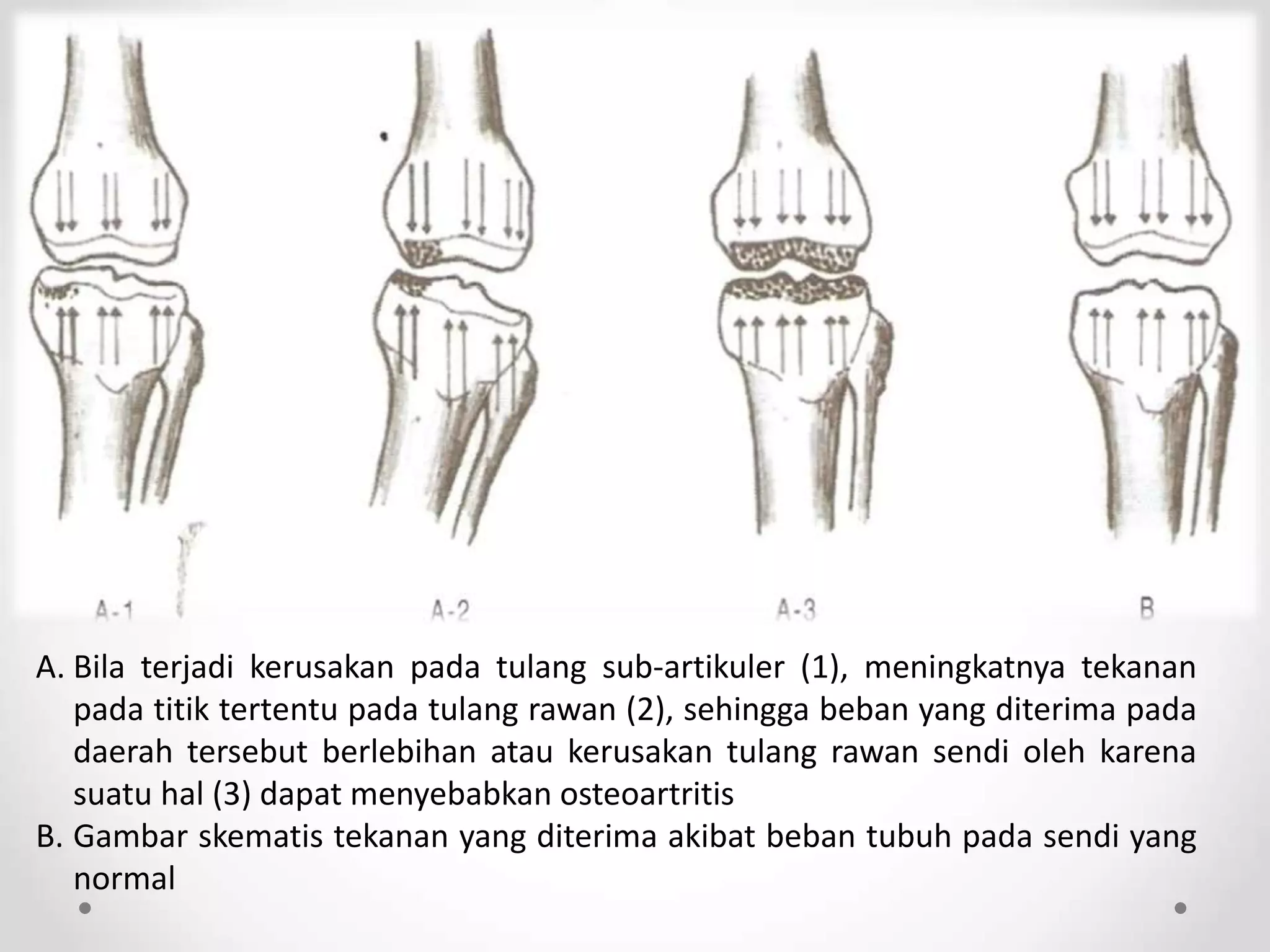 osteoarthritis.ppt