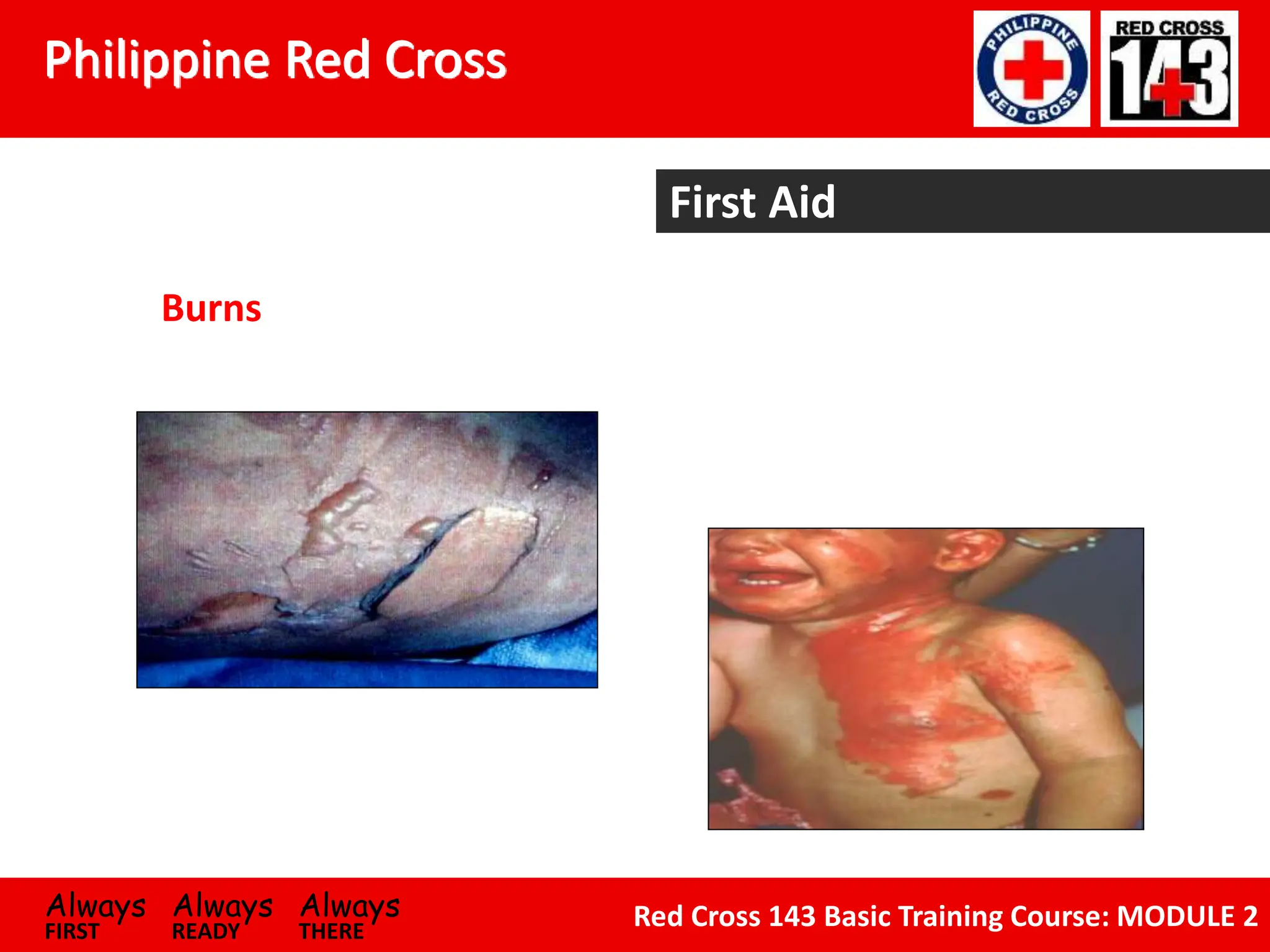 232100753-Ph-Red-Cross-First-Aid-and-BLS.ppt