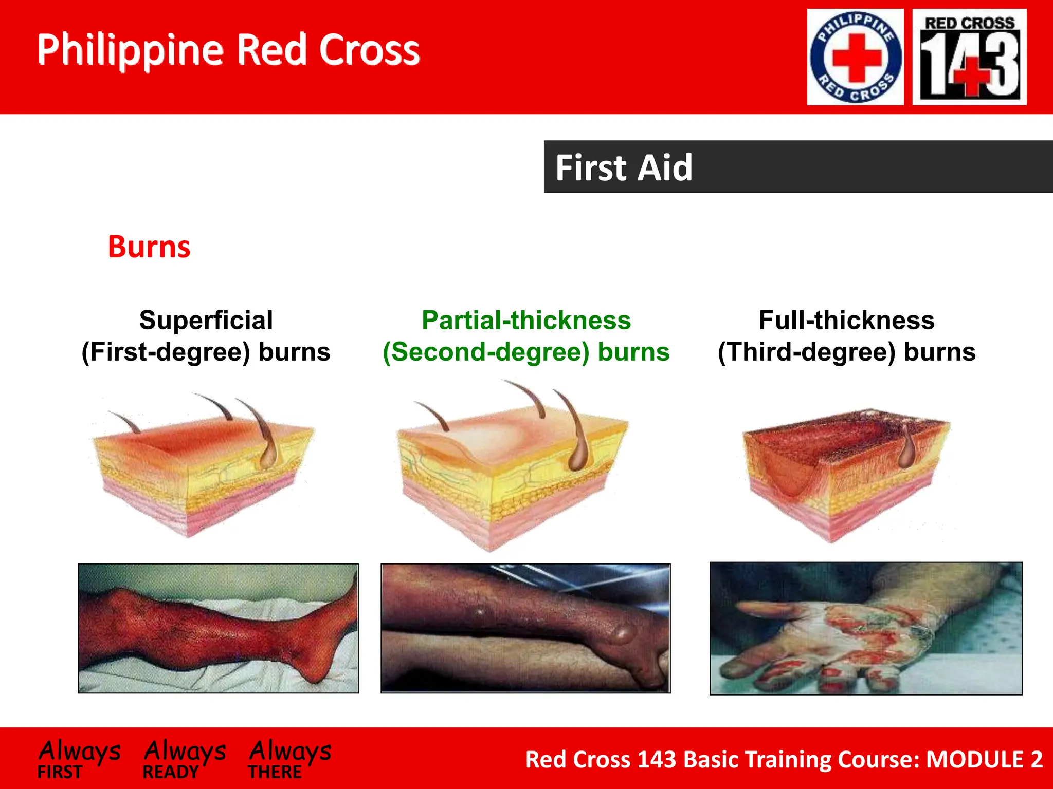 232100753-Ph-Red-Cross-First-Aid-and-BLS.ppt
