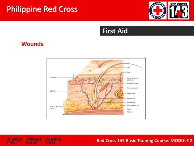 232100753-Ph-Red-Cross-First-Aid-and-BLS.ppt | First Aid | Injuries