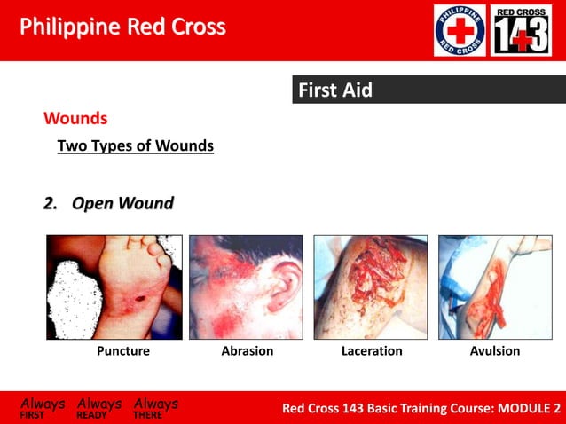 232100753-Ph-Red-Cross-First-Aid-and-BLS.ppt | First Aid | Injuries