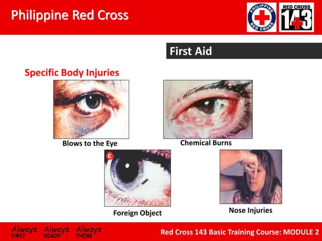 232100753-Ph-Red-Cross-First-Aid-and-BLS.ppt | First Aid | Injuries