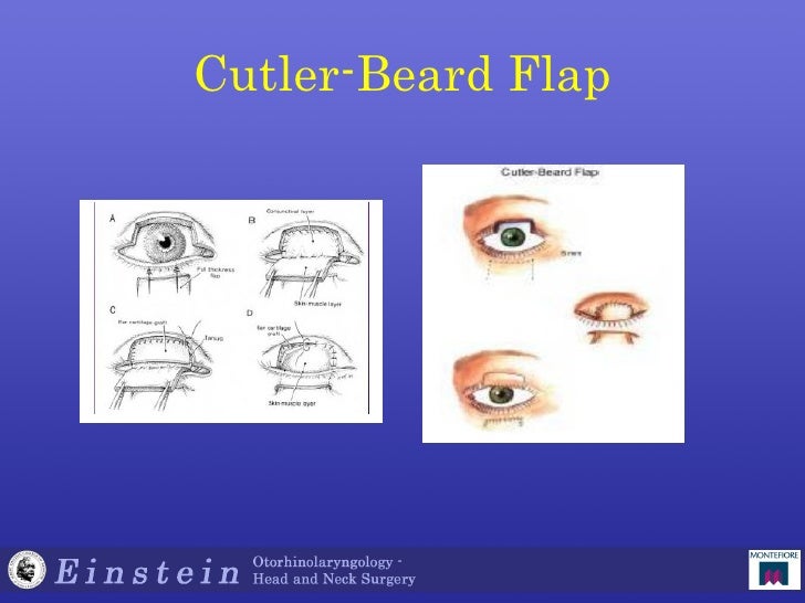 232b Coclia 97 98 Eyelid Reconstruction, Facial Reanimation