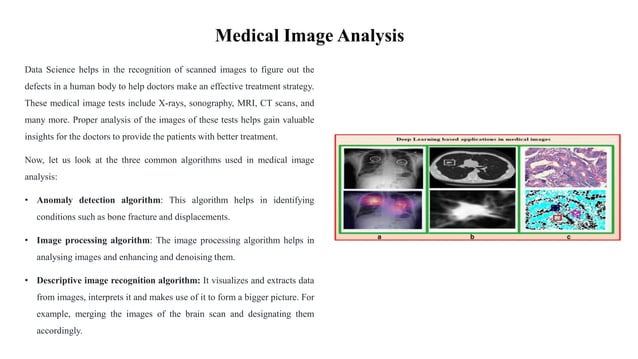 Data science in healthcare.pptx