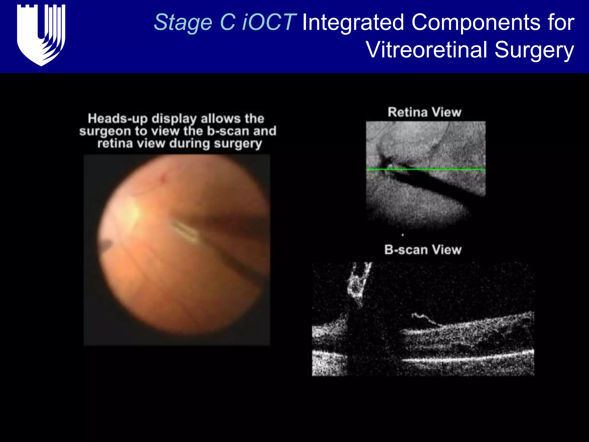 INNOVATION IN RETINAL IMAGING: OPPORTUNITIES & CHALLENGES - History of ...