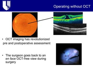 INNOVATION IN RETINAL IMAGING: OPPORTUNITIES & CHALLENGES - History of ...