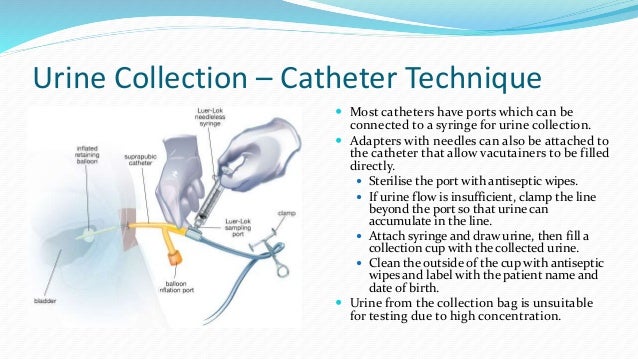 Specimen Collection (updated)