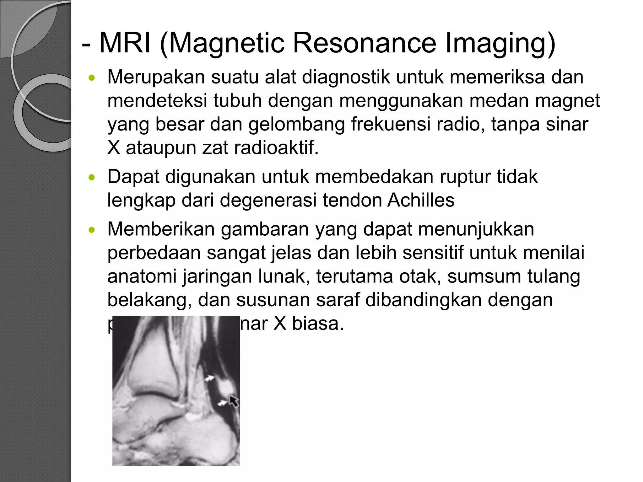 237314131-Yuda-Ruptur-Tendon-Achilles-PPT-Blok-14.pptx