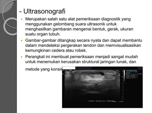 237314131-Yuda-Ruptur-Tendon-Achilles-PPT-Blok-14.pptx
