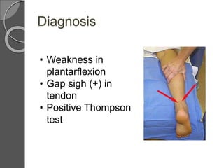 237314131-Yuda-Ruptur-Tendon-Achilles-PPT-Blok-14.pptx