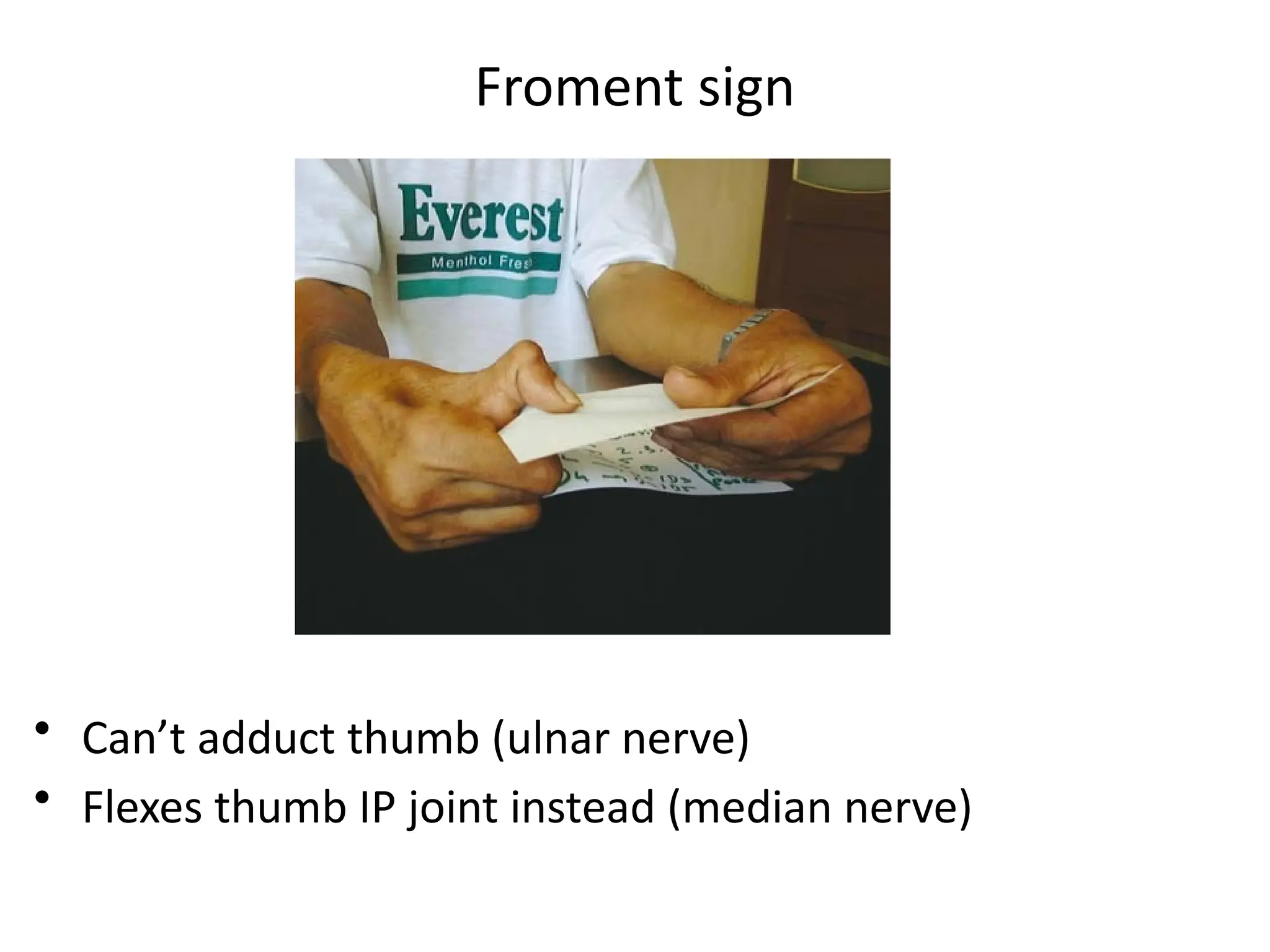 237635845-Compressive-neuropathy-of-upper-limb.pptx