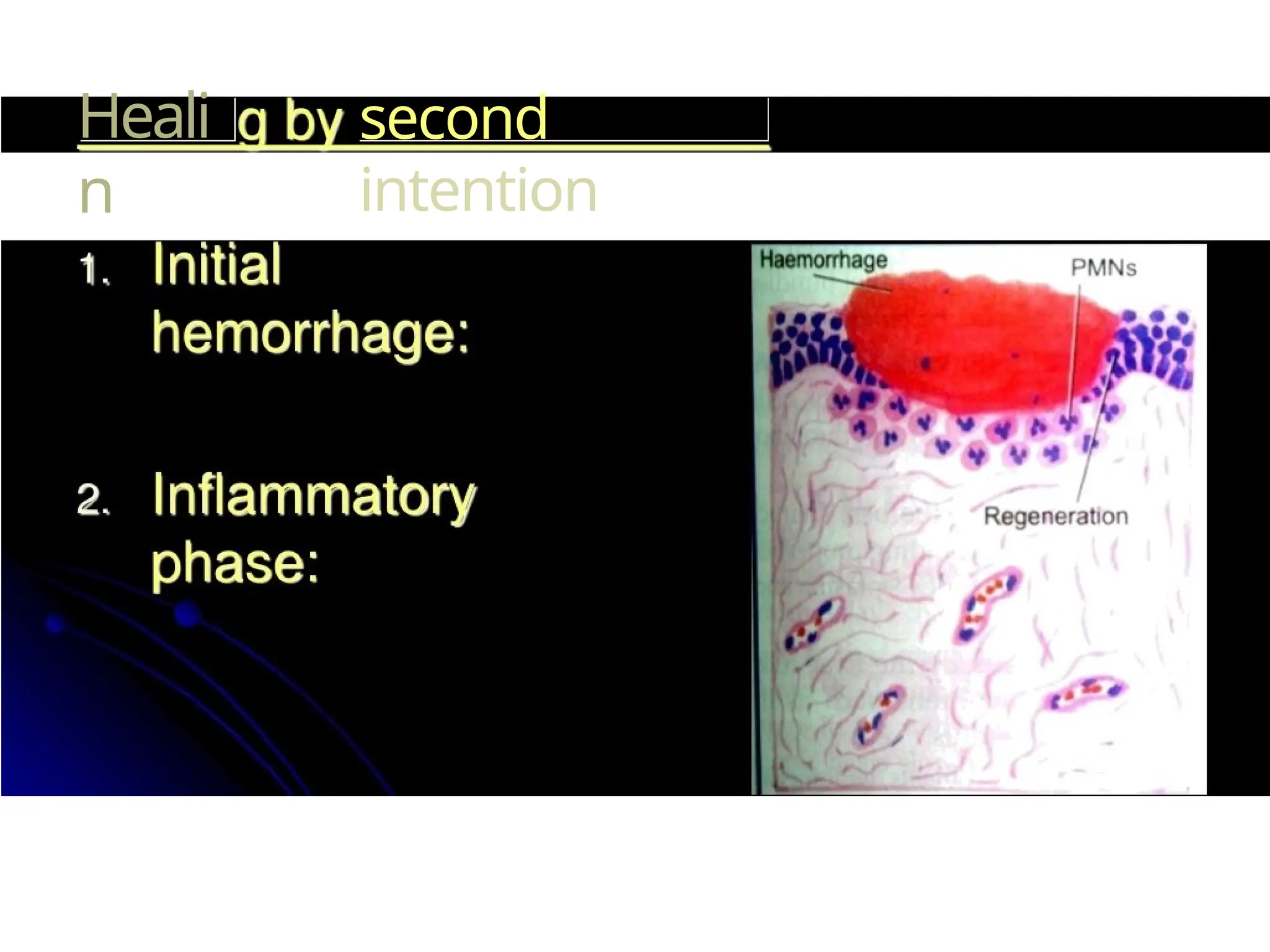 Wound healing process stages 238123310.pptx