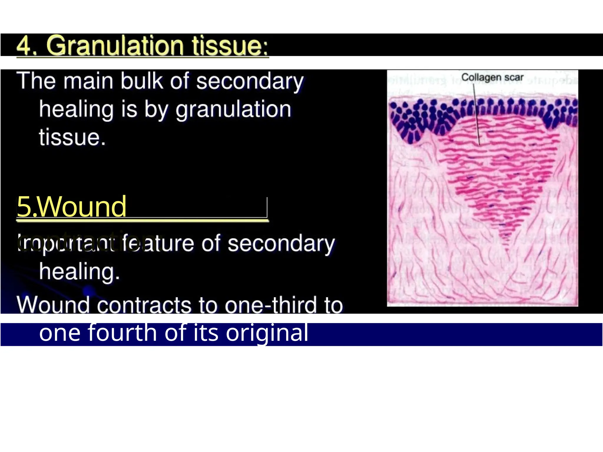 Wound healing process stages 238123310.pptx