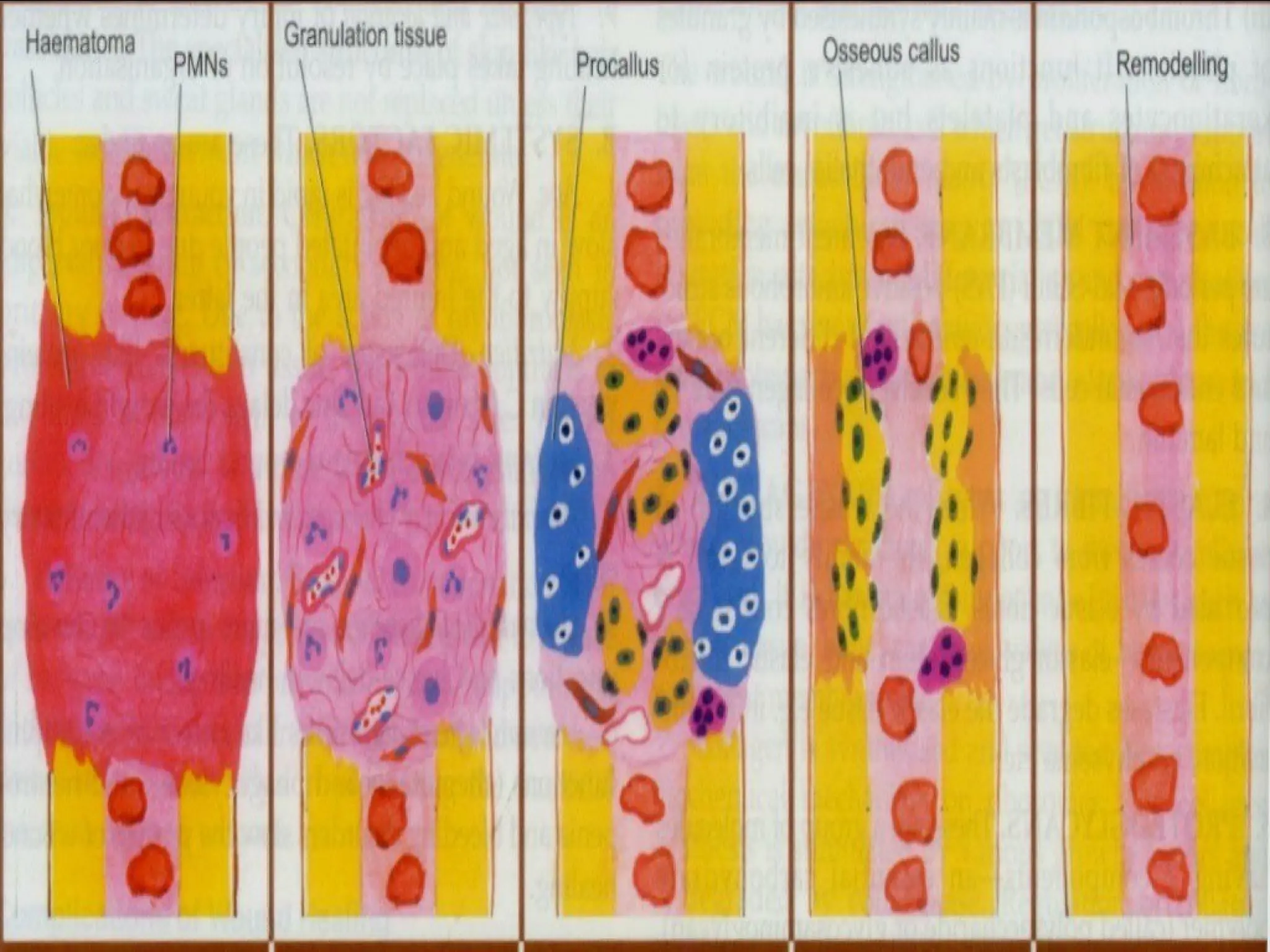 Wound healing process stages 238123310.pptx