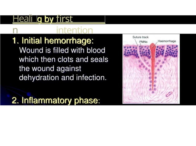 Wound healing process stages 238123310.pptx