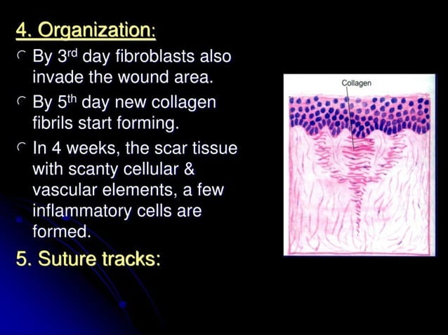 Wound healing process stages 238123310.pptx