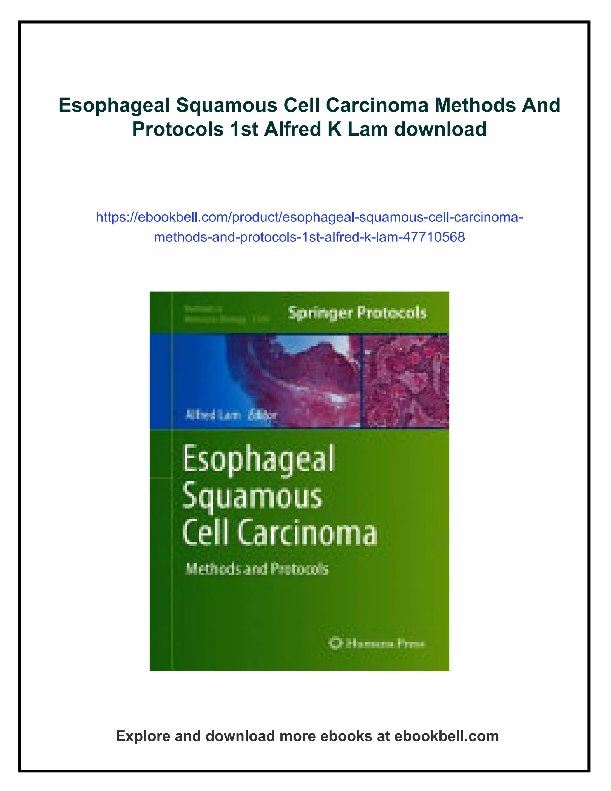 Esophageal Squamous Cell Carcinoma Methods And Protocols 1st Alfred K ...