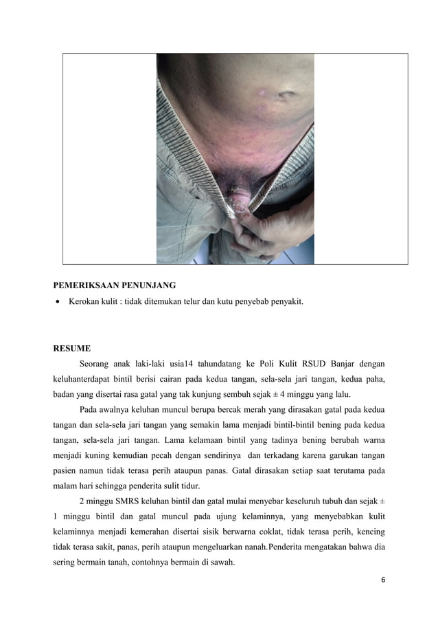 239776755 dr-bowo-lapkas-scabies | DOC