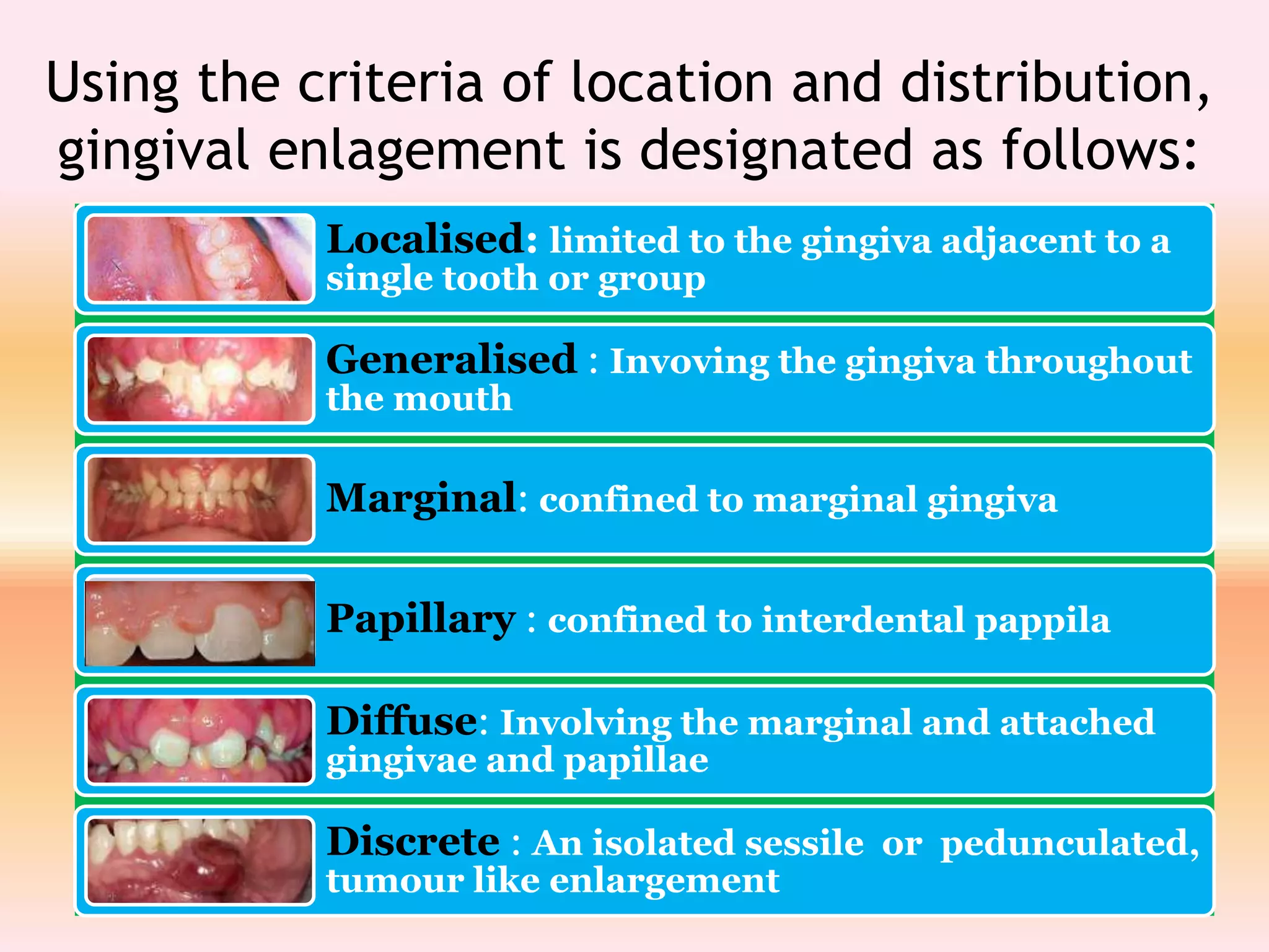 gingival enlargement | PPTX