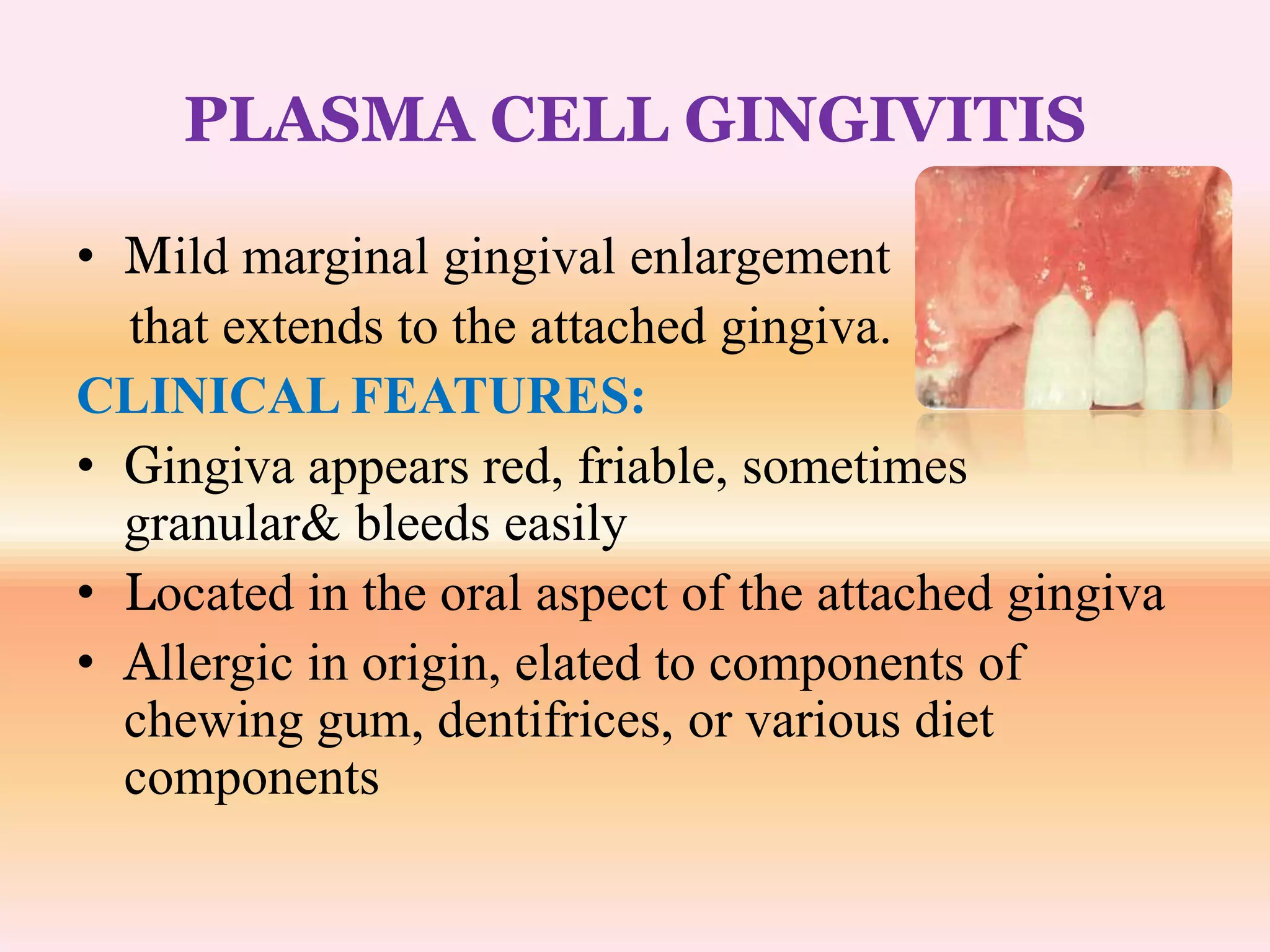 gingival enlargement | PPTX