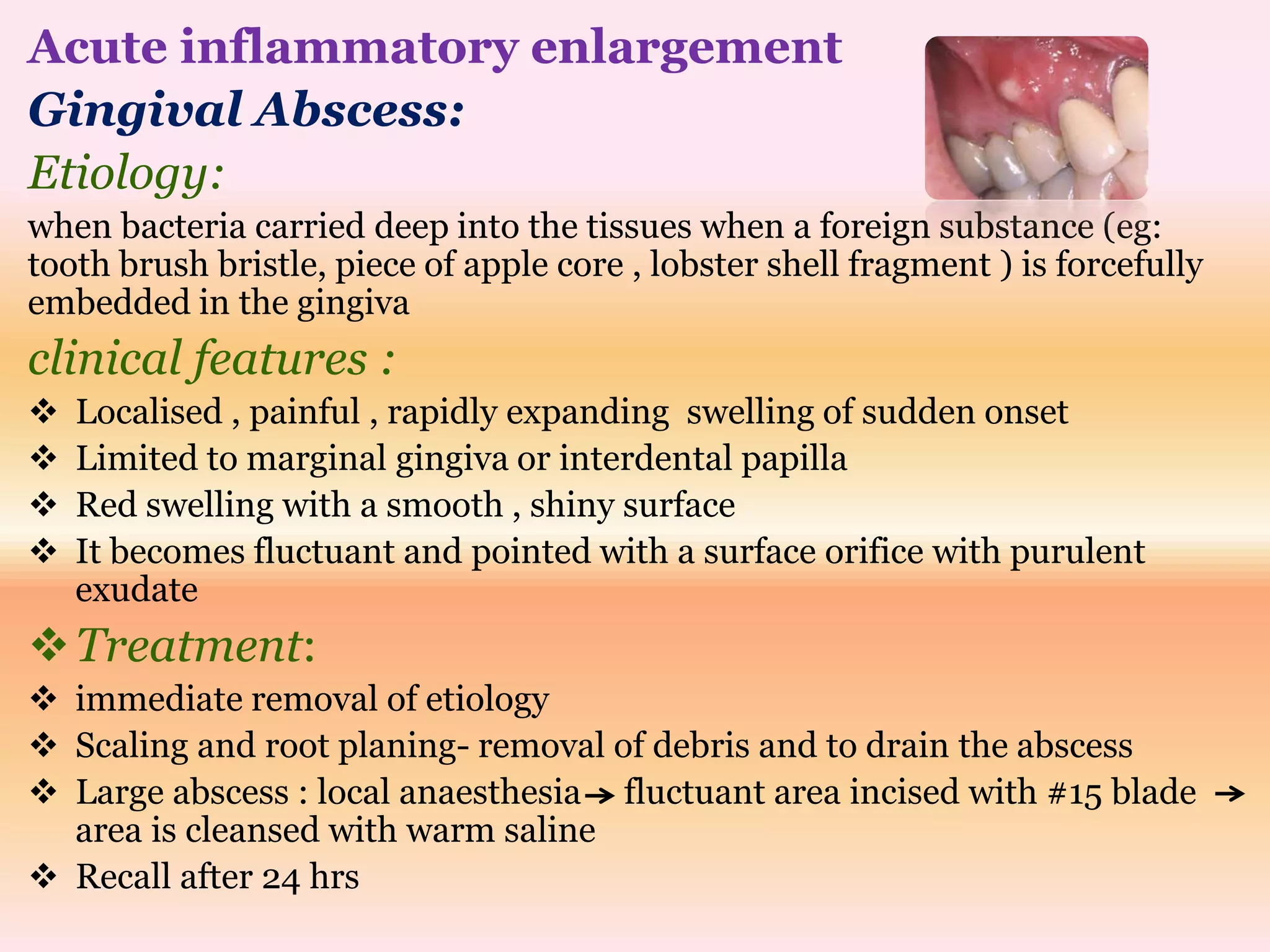 gingival enlargement | PPTX