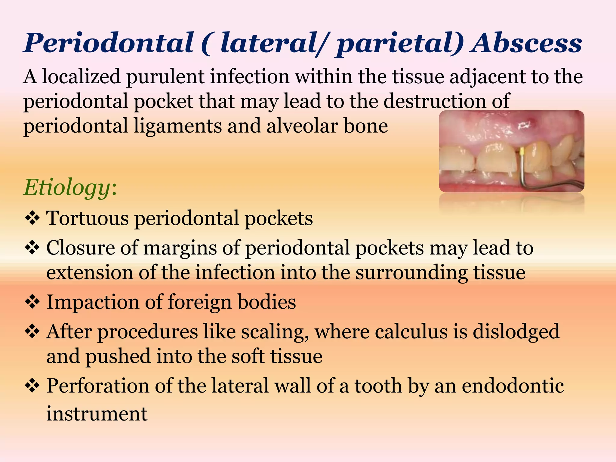 gingival enlargement | PPTX