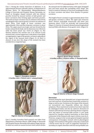 An Unusual Shapes of Stomach Case Report on Hourglass and Retort Shape ...