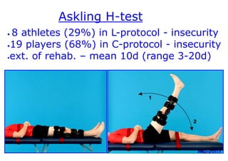 Carl Askling - Lengthening type of exercises are effective | PDF