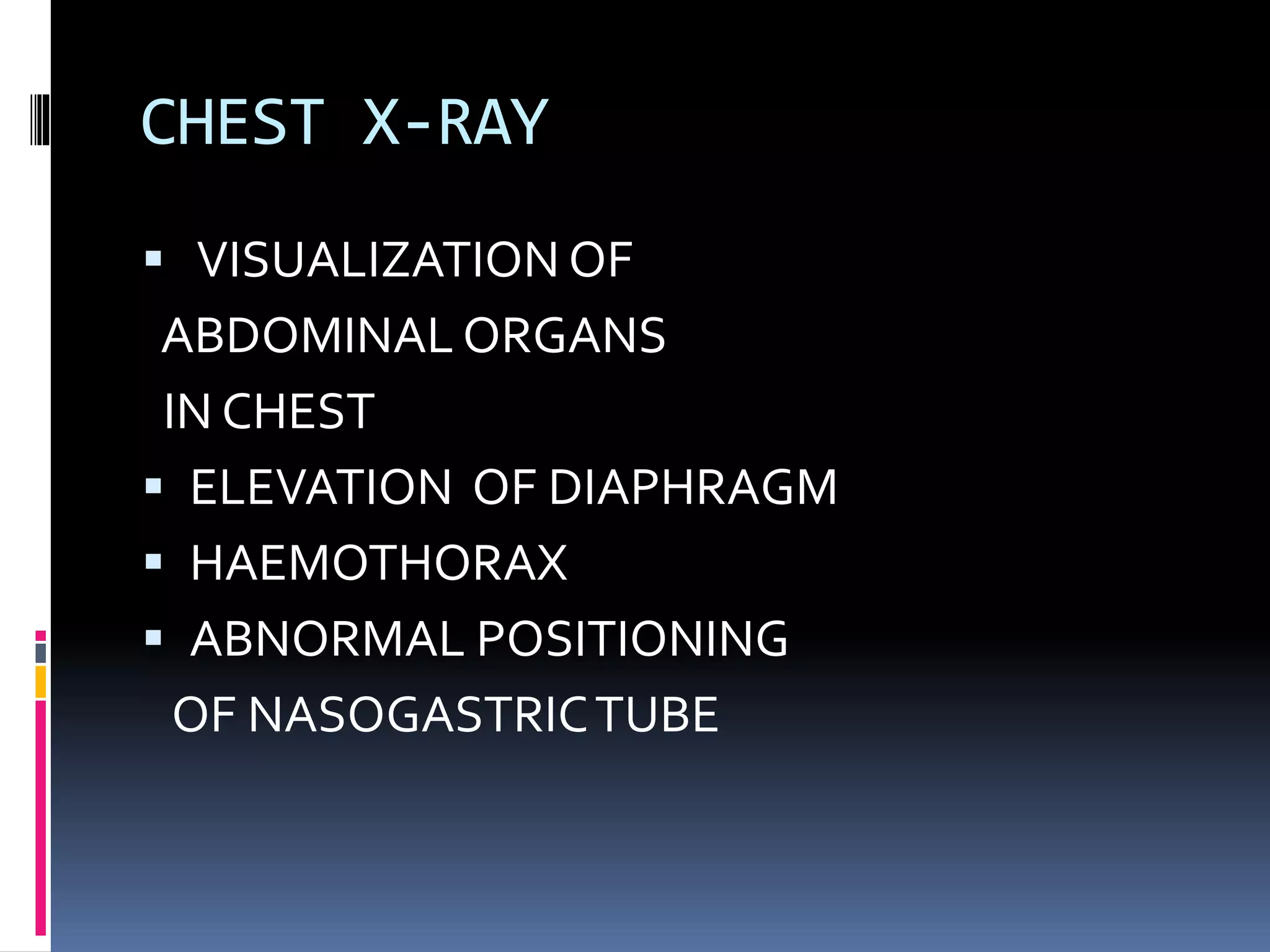 JUNCTIONAL ZONES OF TORSO TRAUMA | PPTX