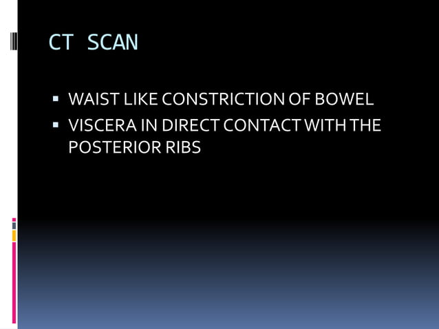 JUNCTIONAL ZONES OF TORSO TRAUMA | PPT