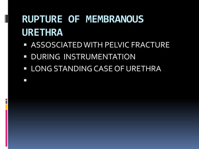 JUNCTIONAL ZONES OF TORSO TRAUMA | PPT