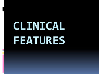 JUNCTIONAL ZONES OF TORSO TRAUMA | PPTX