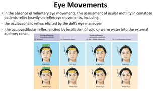 Roving Eye Movements