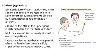 approach to coma | PPT