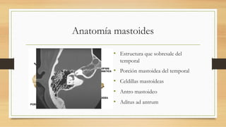 Mastoides y silla tucar en imagen radiografias | PDF
