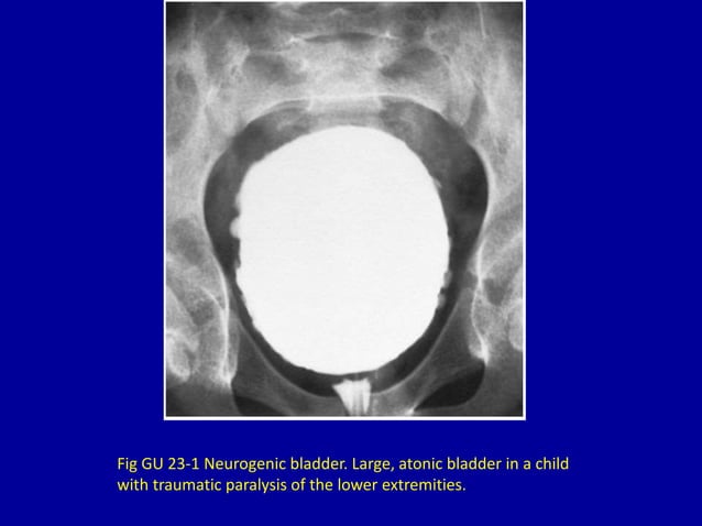 23 large urinary bladder | PPTX