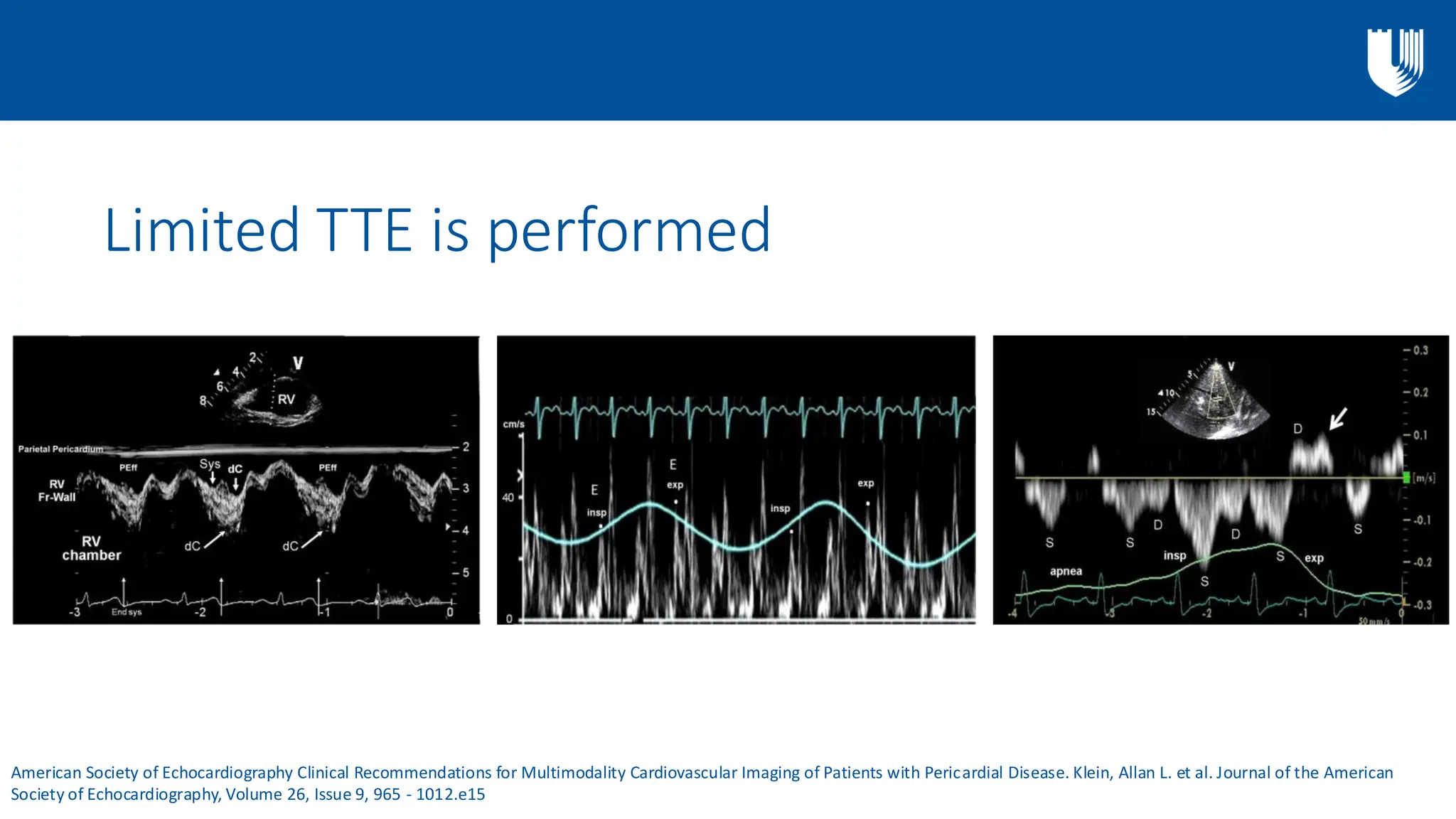 Case Study Comparison: Cardiac POCUS vs. Comprehensive TTE | PDF
