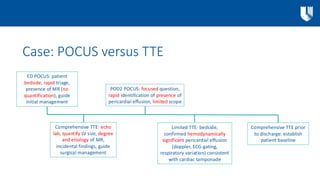 Case Study Comparison: Cardiac POCUS vs. Comprehensive TTE | PDF
