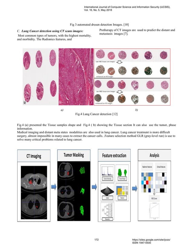 Survey Of Feature Selection Extraction Methods Used In Biomedical