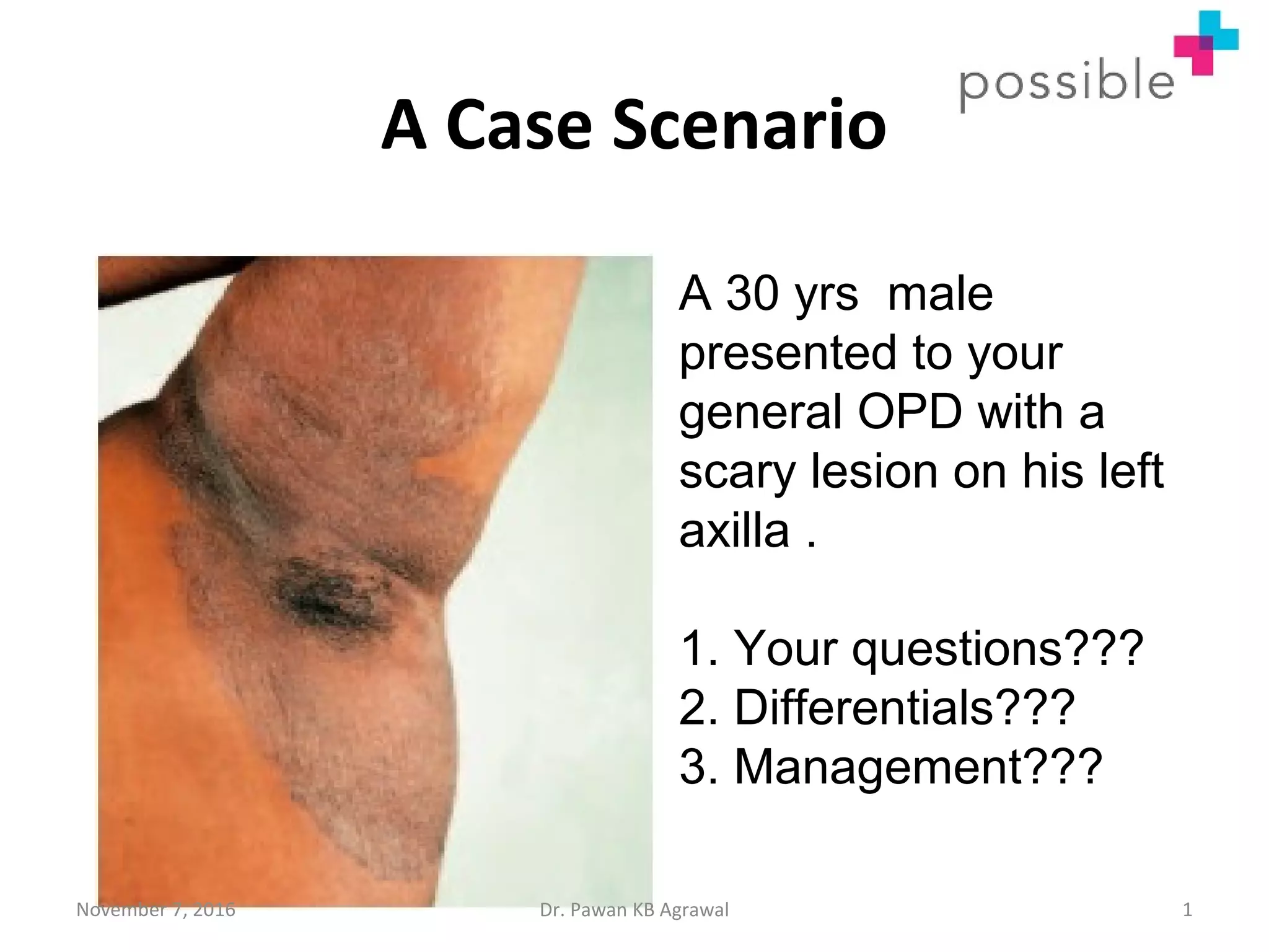 bacterial skin infections in general OPD | PPT