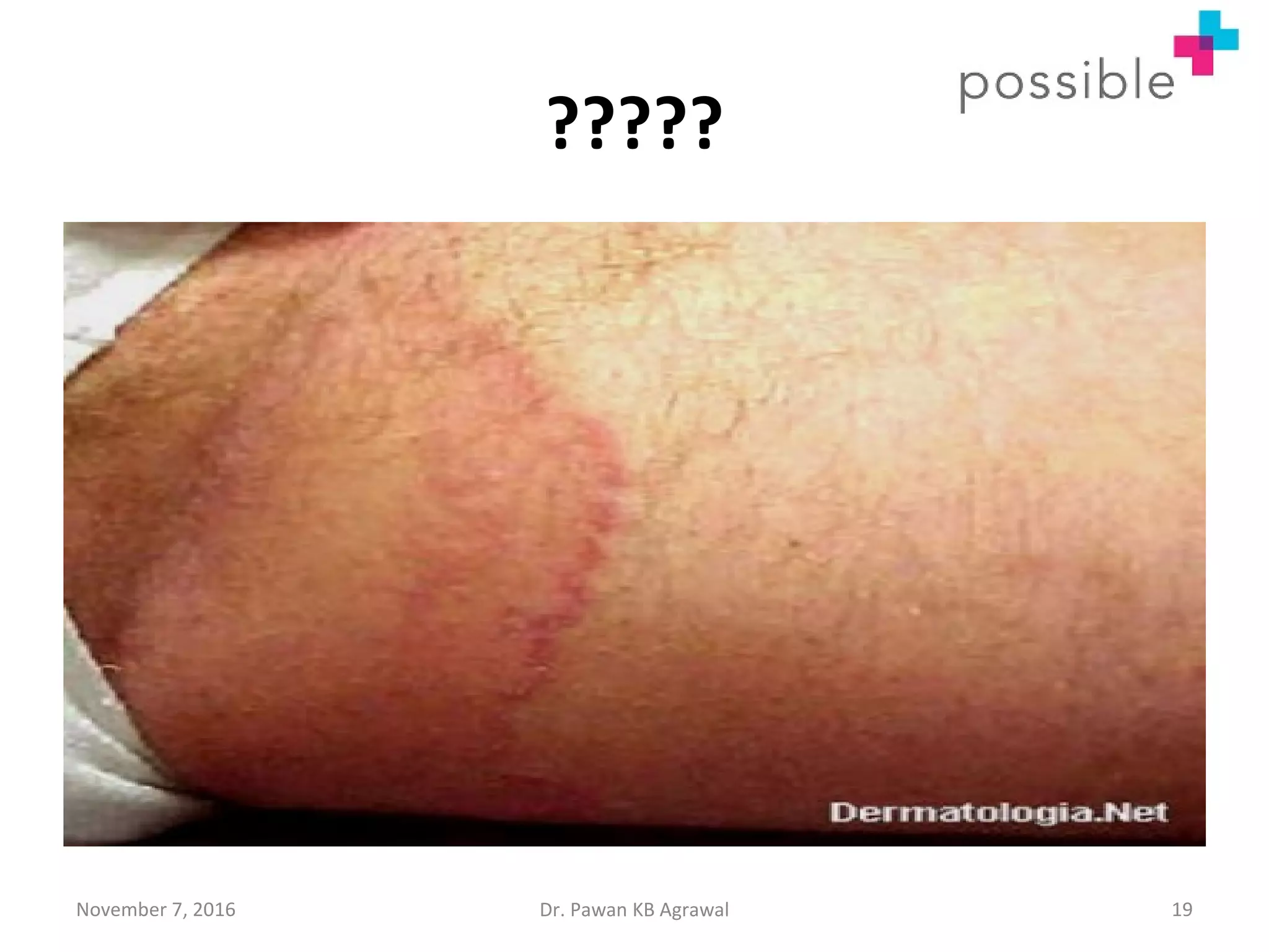 bacterial skin infections in general OPD | PPT