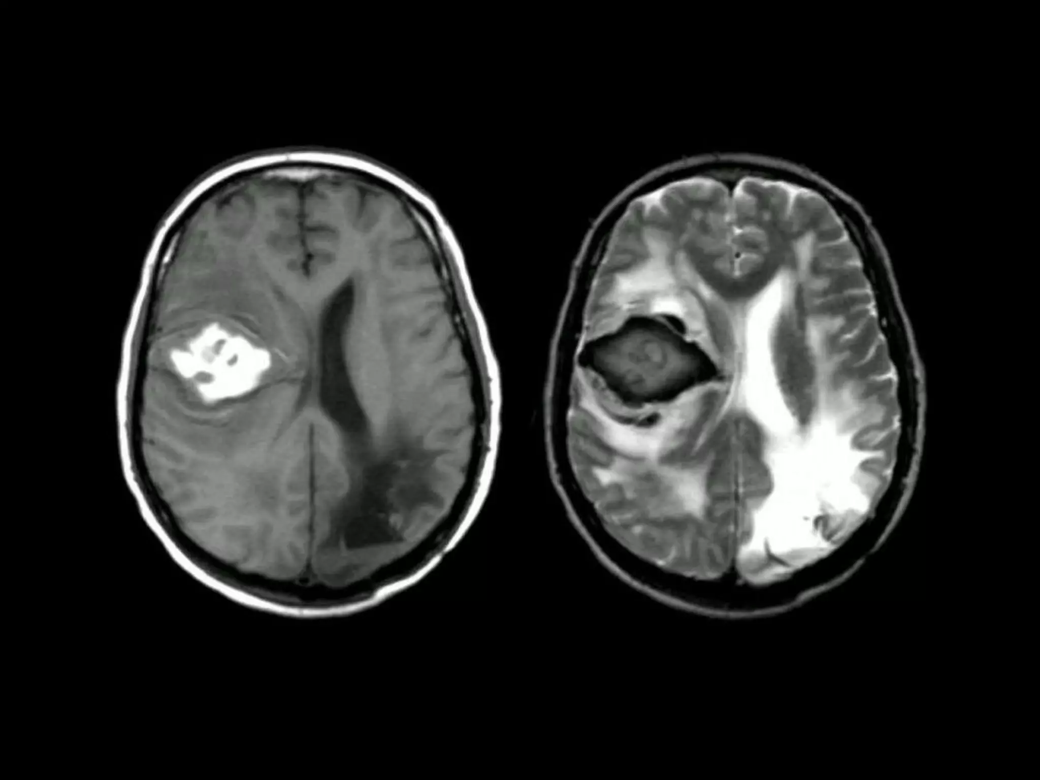 MRI basics - How to read and understand MRI sequences | PPTX