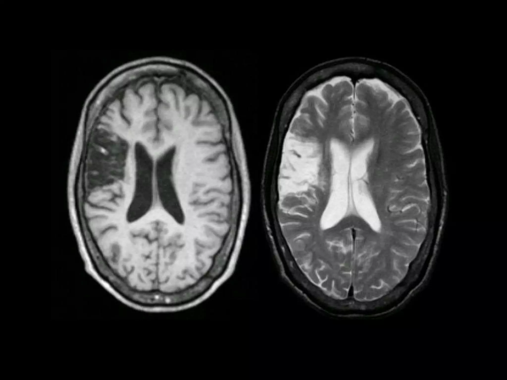 MRI basics - How to read and understand MRI sequences | PPTX