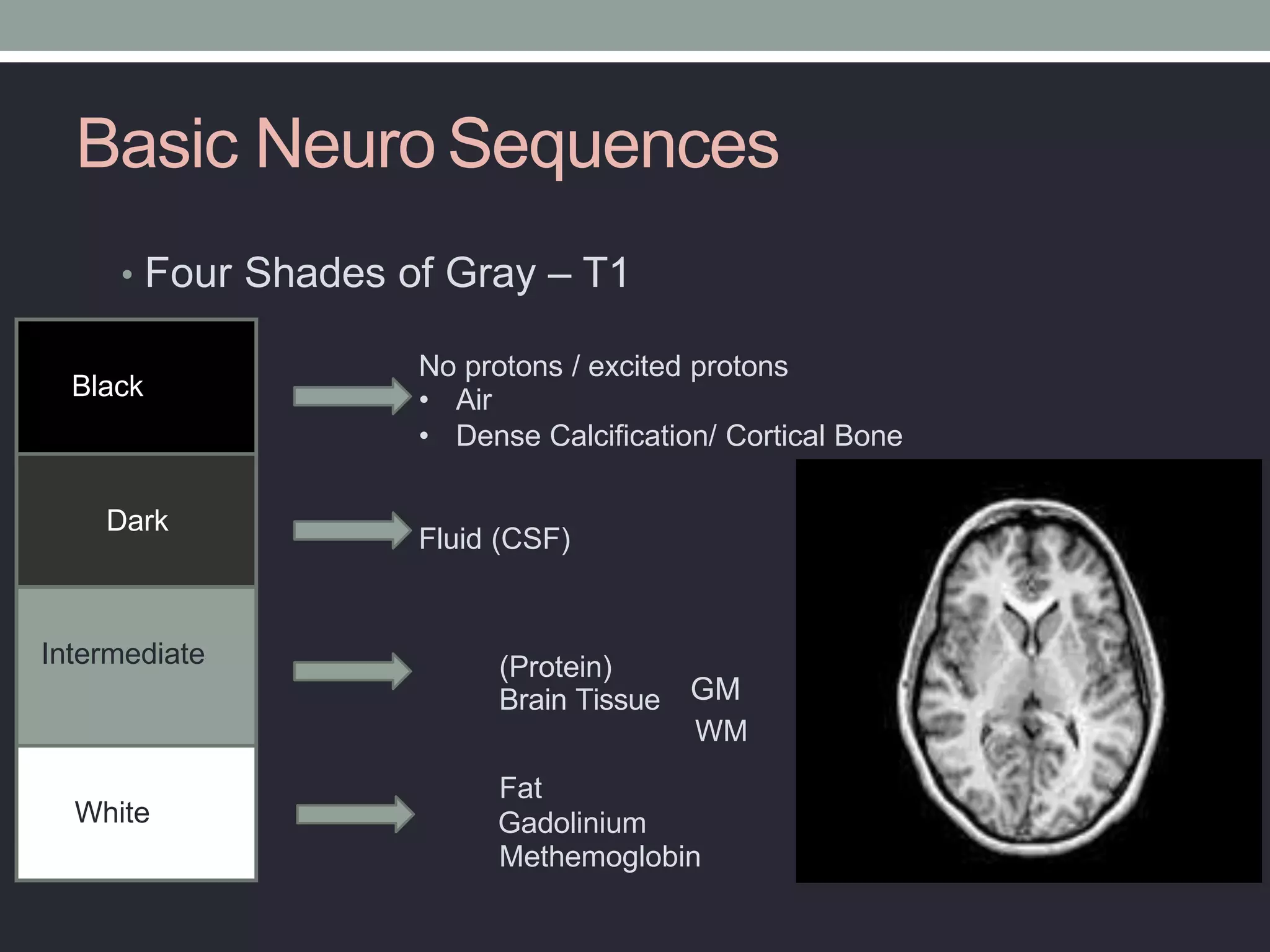 MRI basics - How to read and understand MRI sequences | PPTX