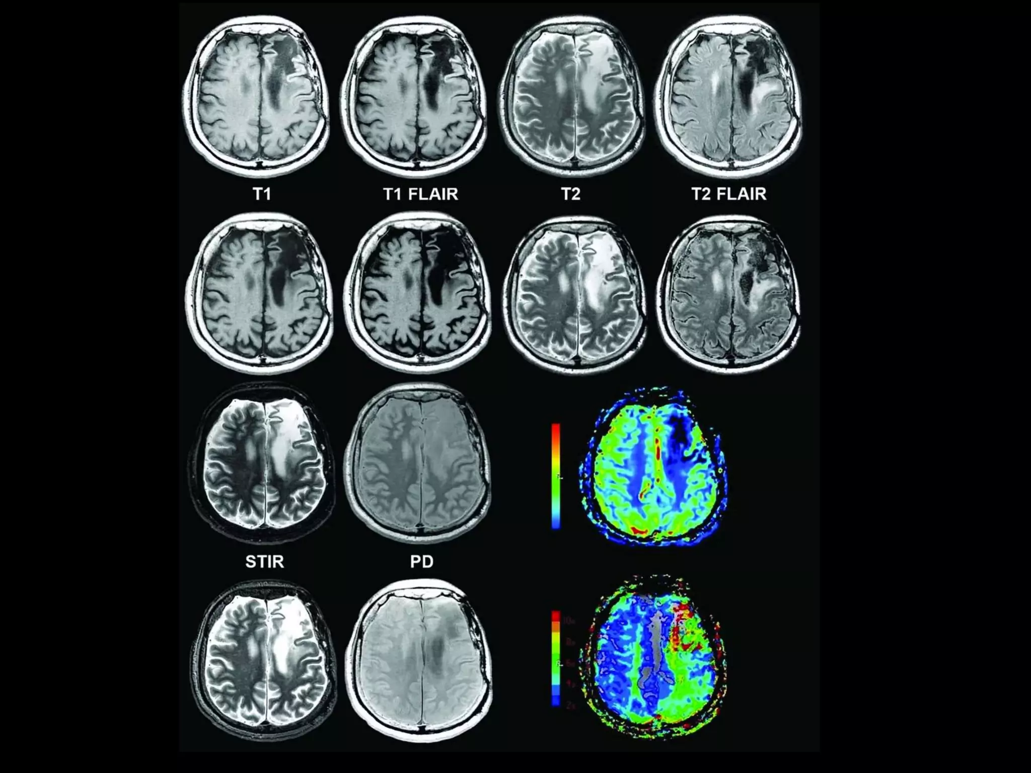 MRI basics - How to read and understand MRI sequences | PPTX